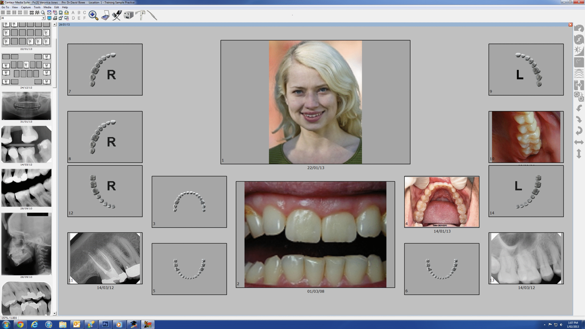 AI-Powered Dental Imaging for Enhanced Diagnostic Accuracy | Centaur ...